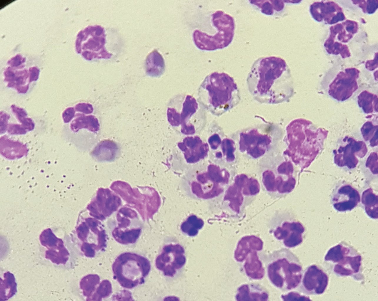 Superficial Pyoderma in Dogs: Clinical Overview & Diagnosis